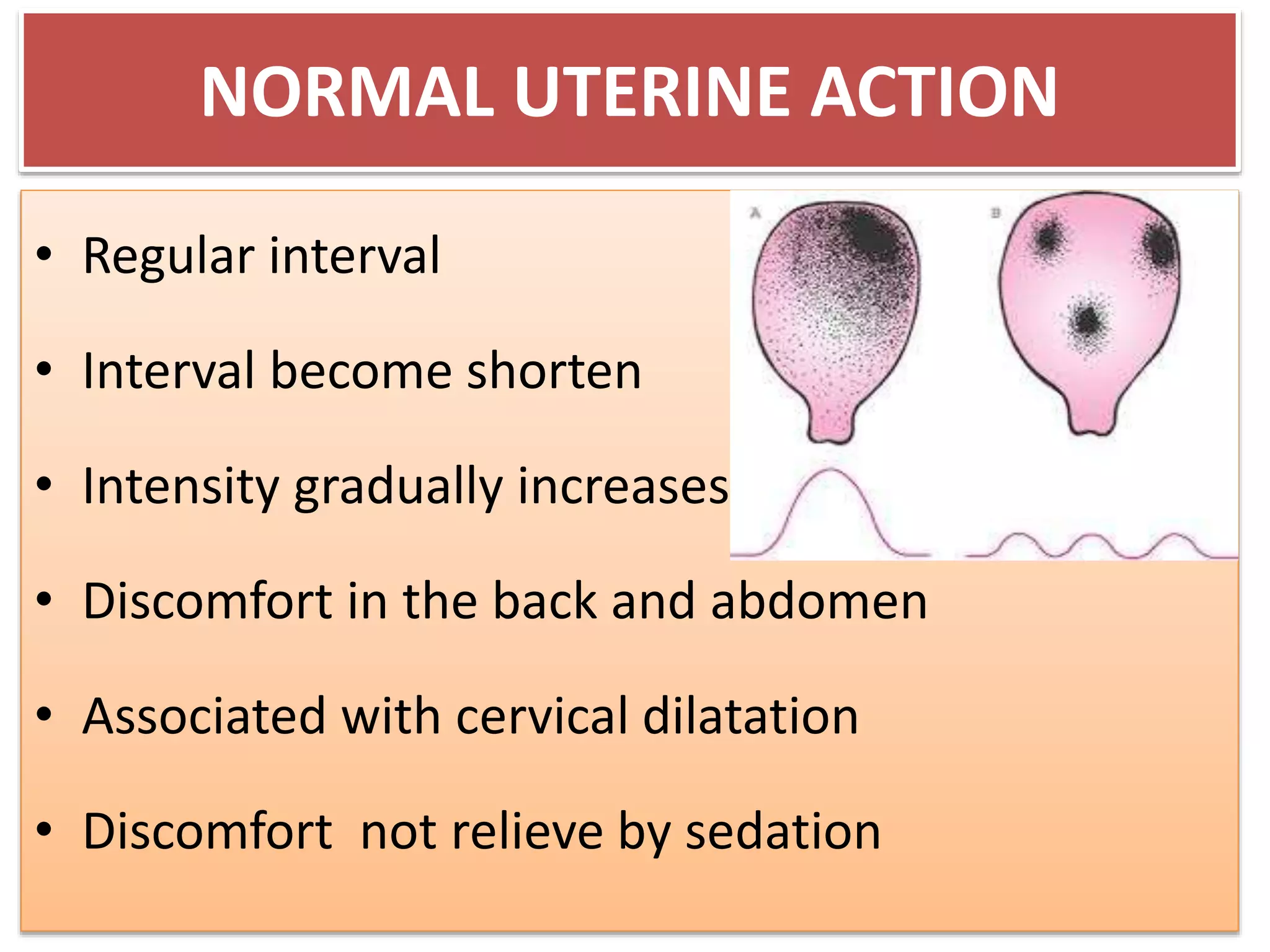 Uterine Inertia, Precipitate Labor and Uterine Tetany | PPTX