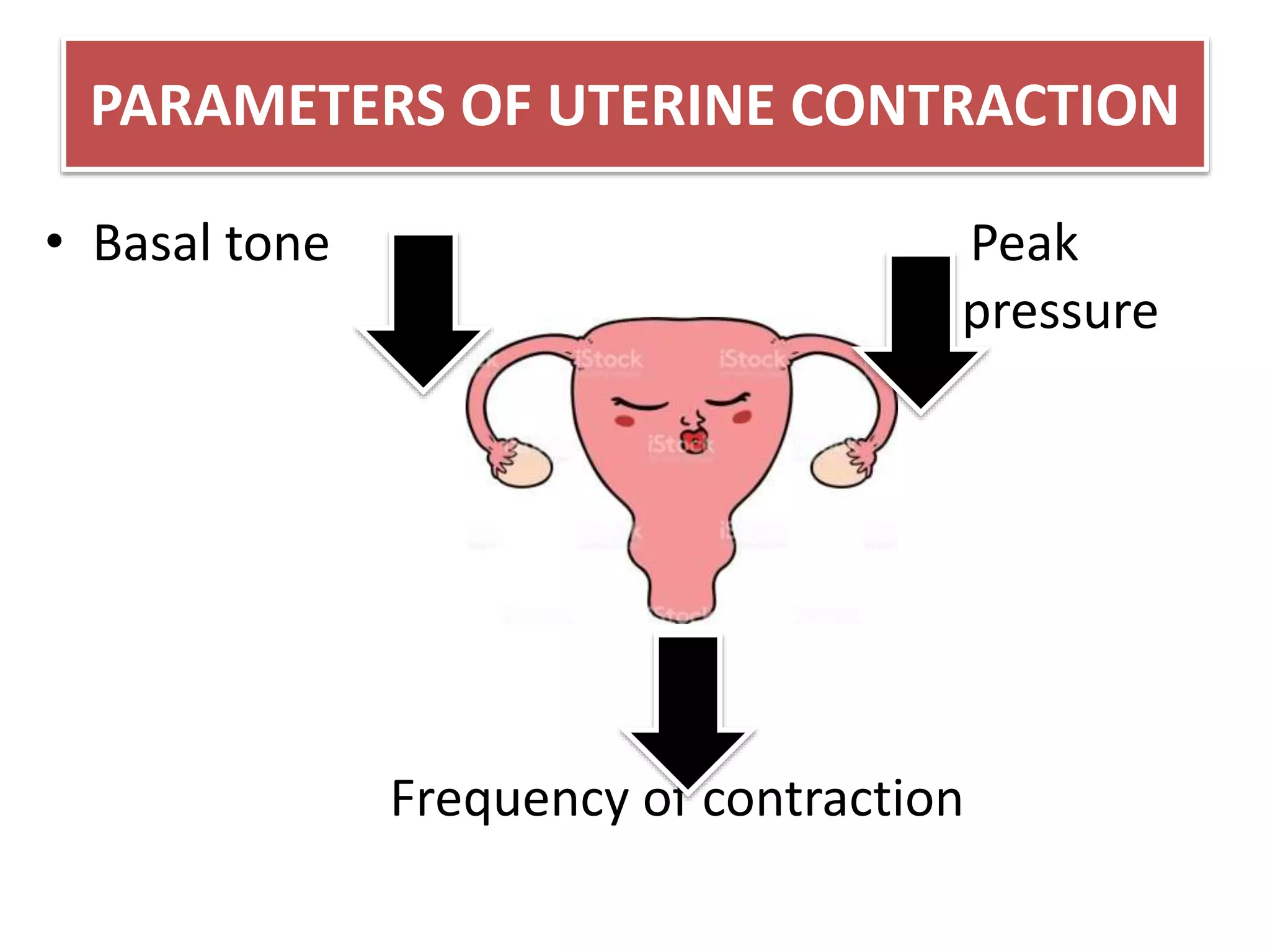 Uterine Inertia, Precipitate Labor and Uterine Tetany | PPTX