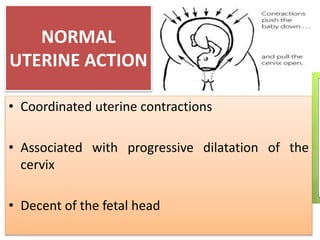Uterine Inertia, Precipitate Labor and Uterine Tetany | PPTX