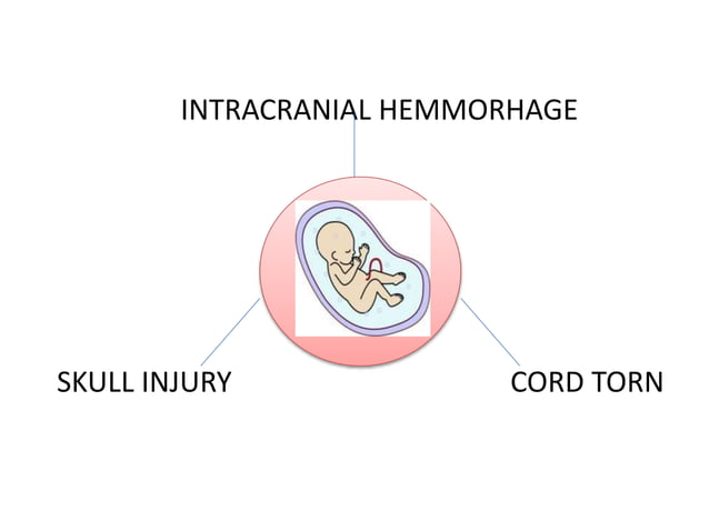Uterine Inertia In Humans , uterine inertia – Leo Löwchen