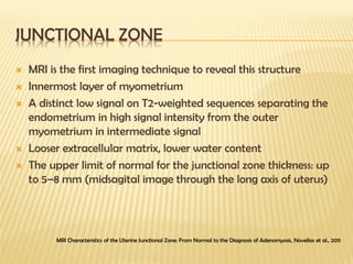 Uterine Tumours | PDF