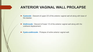Uterovaginal prolapse | PPTX