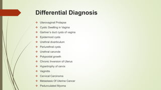 Uterovaginal prolapse | PPTX