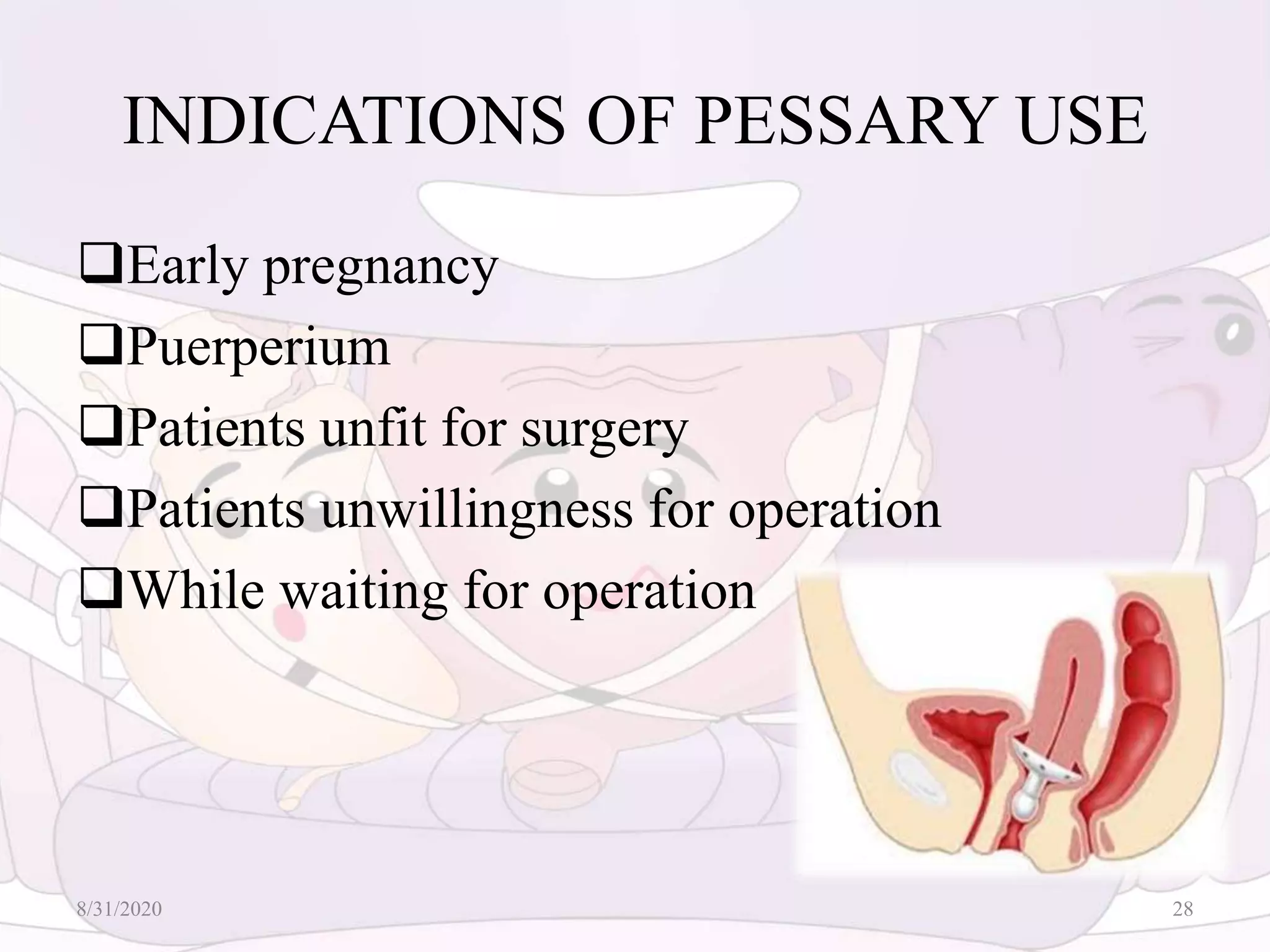 Utero vaginal prolapse | PPTX
