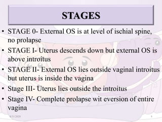 Utero vaginal prolapse | PPTX