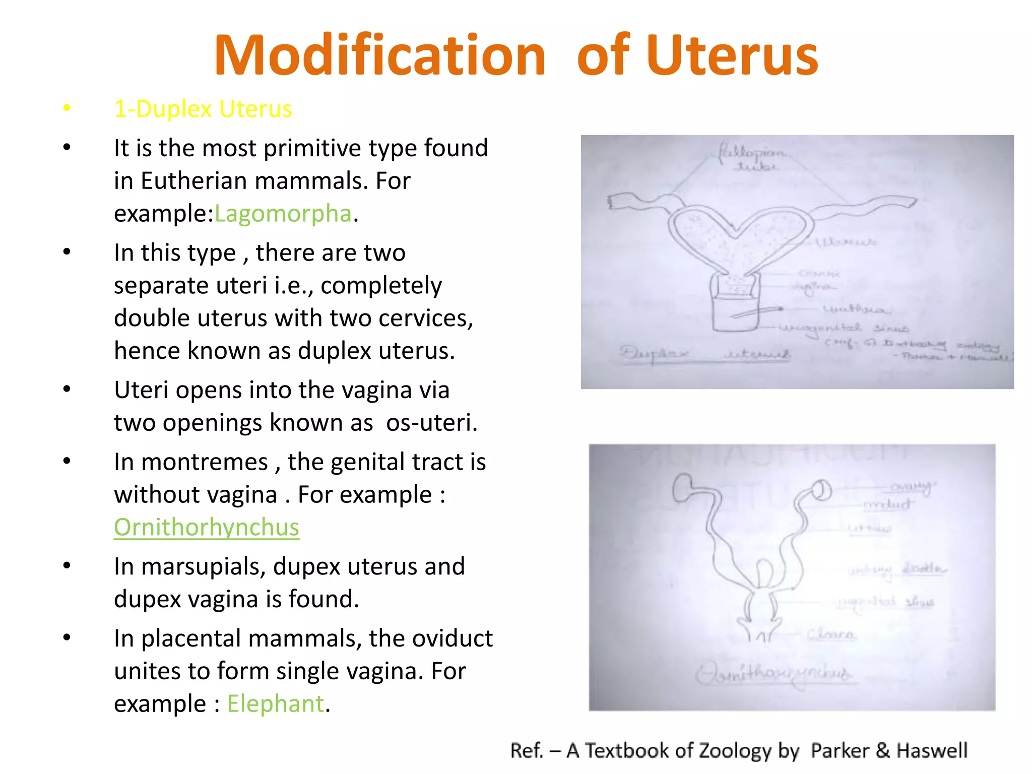 UTERUS.pptx