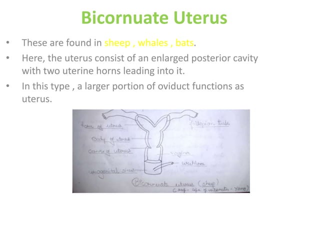 UTERUS.pptx