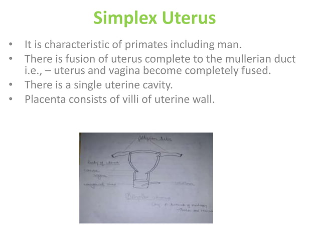 UTERUS.pptx