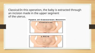 Uterus anatomy embryology, and clinical aspects | PPTX