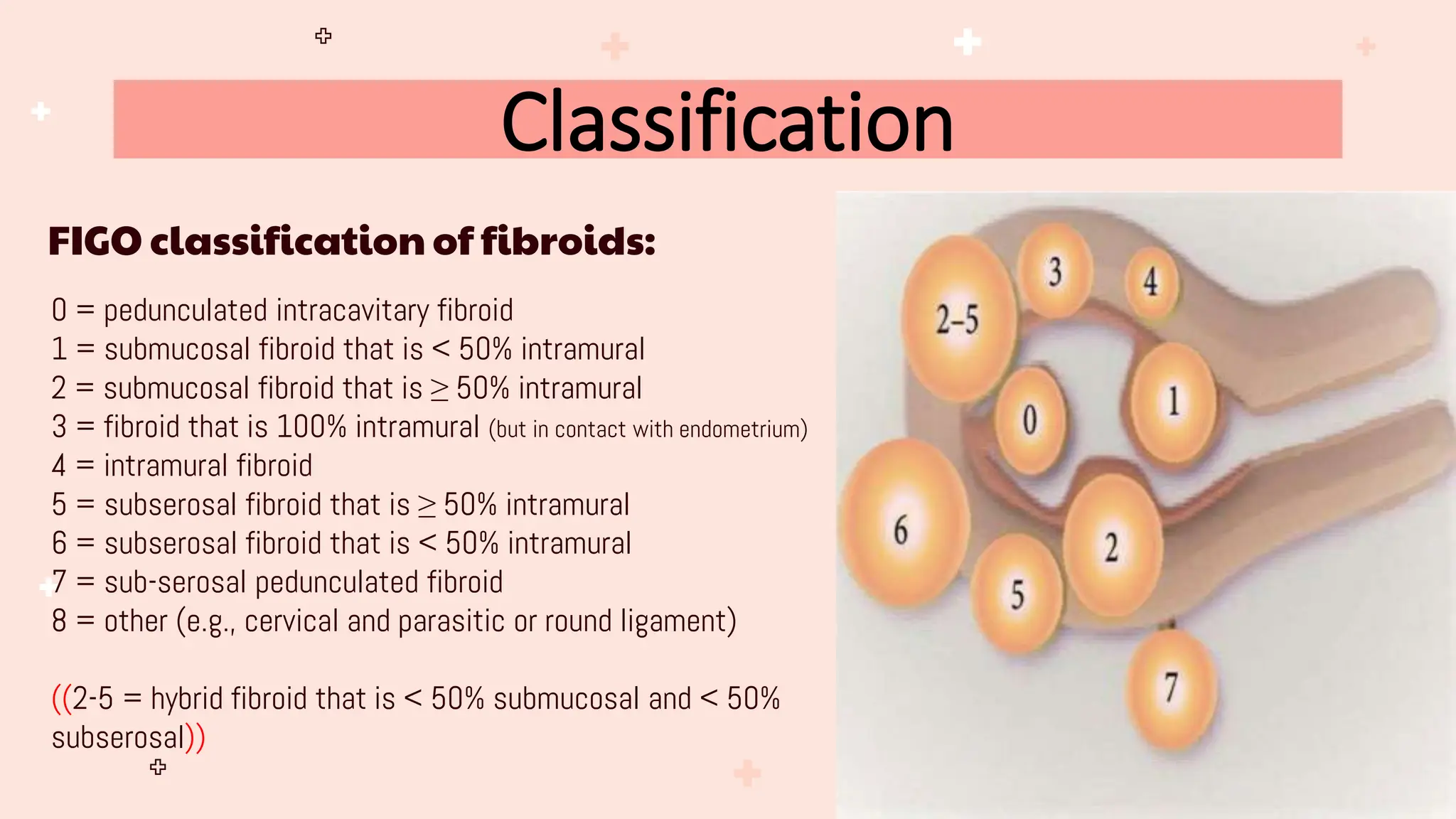 Uterus Fibroids Disease | PDF