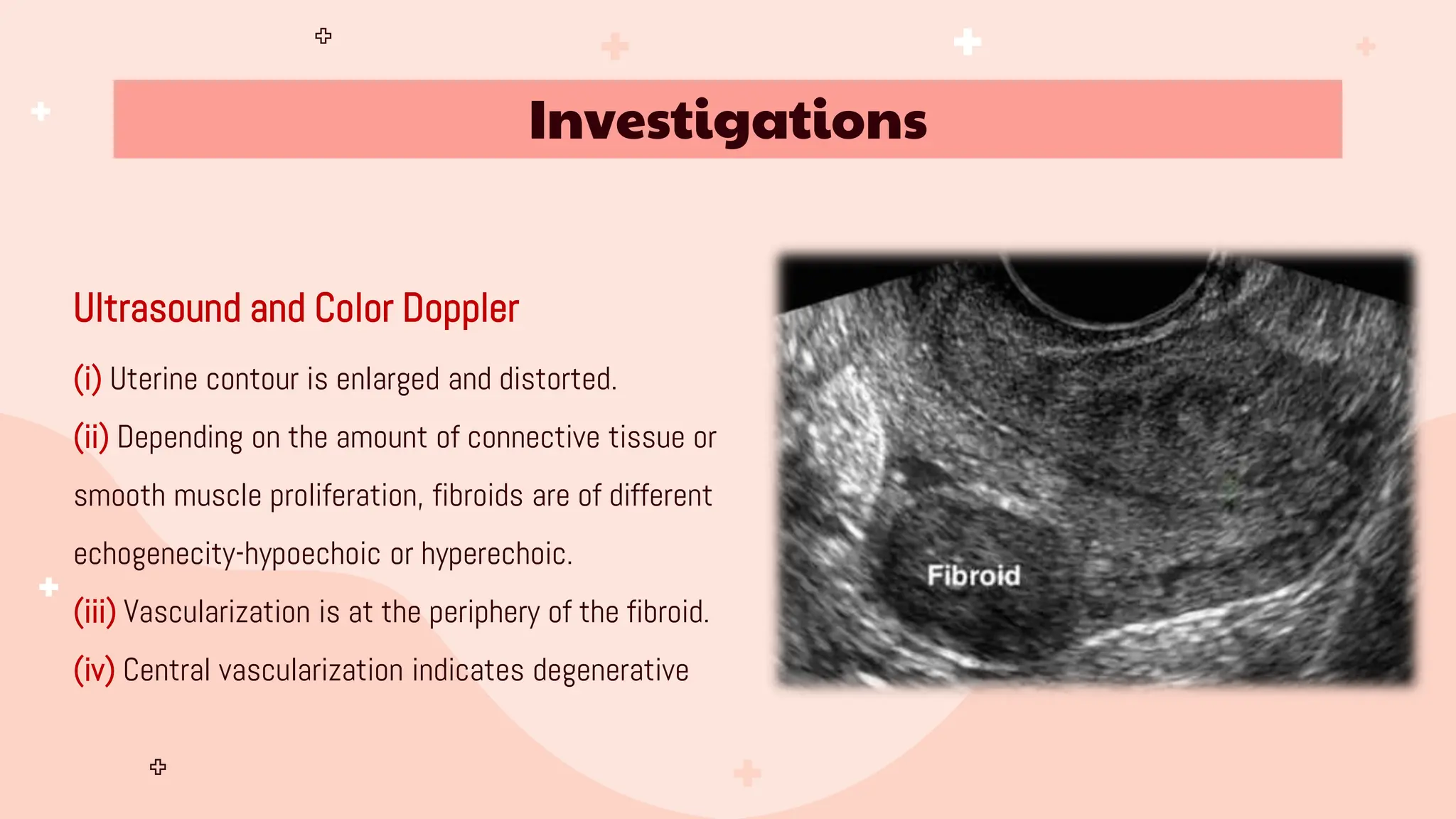 Uterus Fibroids Disease | PDF