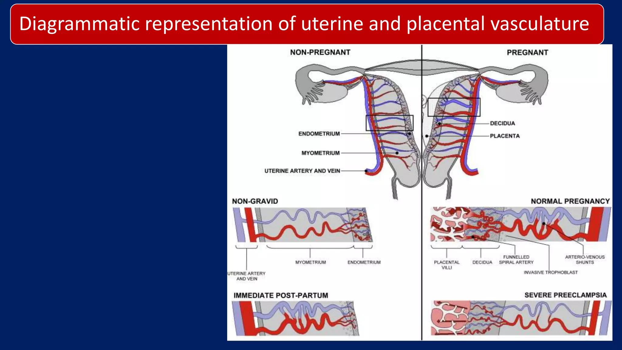 UTERUS AND INFERTILITY | PPTX