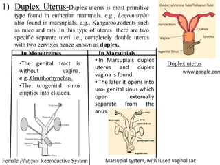 uterus modification.pptx