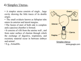 uterus modification.pptx