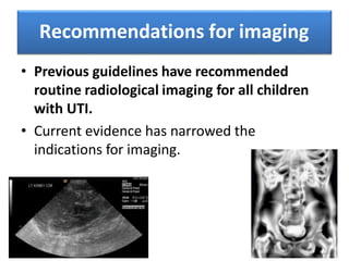 uti-160315210213.pptxDDDDDDDDDDDDDDDDDDDD | PPTX