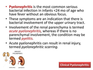 Urinary Tract Infections in children | PPTX