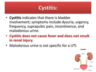 Urinary Tract Infections in children | PPTX