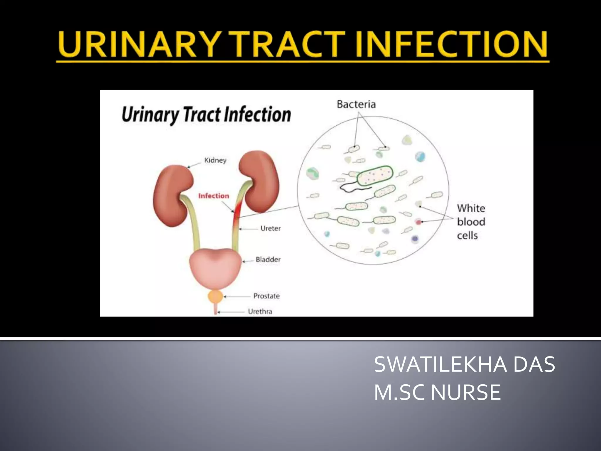 Urinary Tract Infection with Nursing Management | PPTX