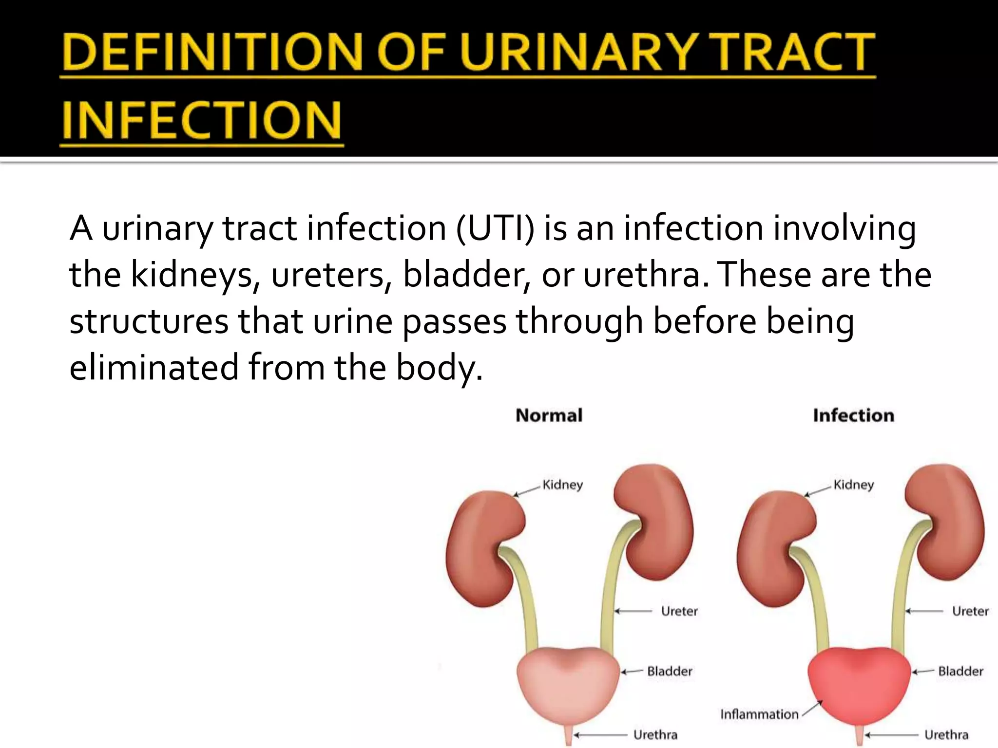 Urinary Tract Infection with Nursing Management | PPTX