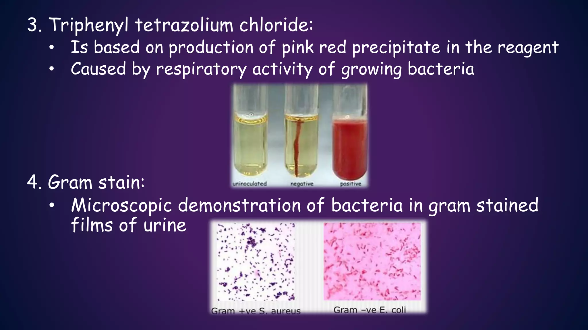 Urinary Tract Infection (UTI) | PPT