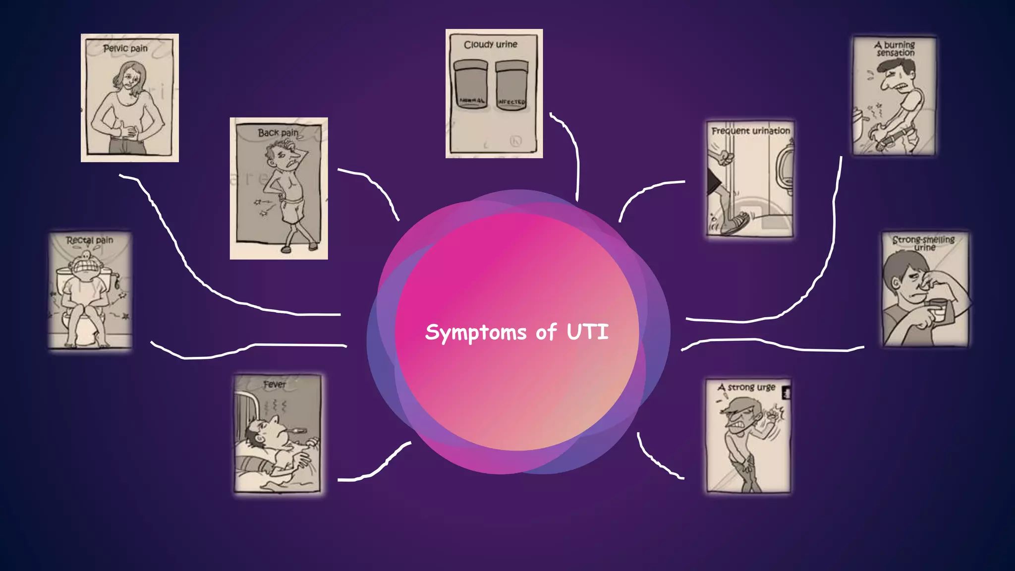 Urinary Tract Infection (UTI) | PPT