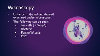 Urinary Tract Infection (UTI) | PPT