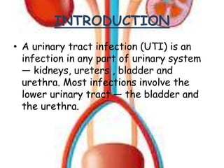 UTI.pptx