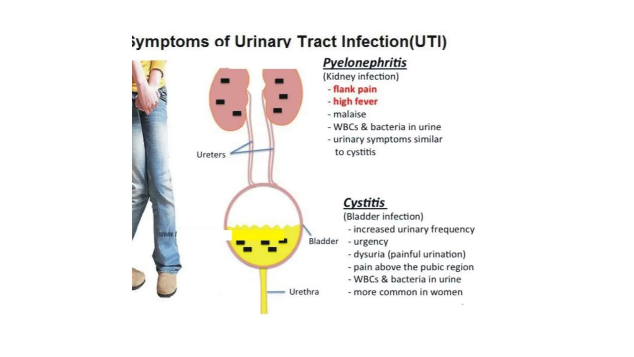 URINARY TRACT INFECTION URINARY TRACT INFECTION | PPTX