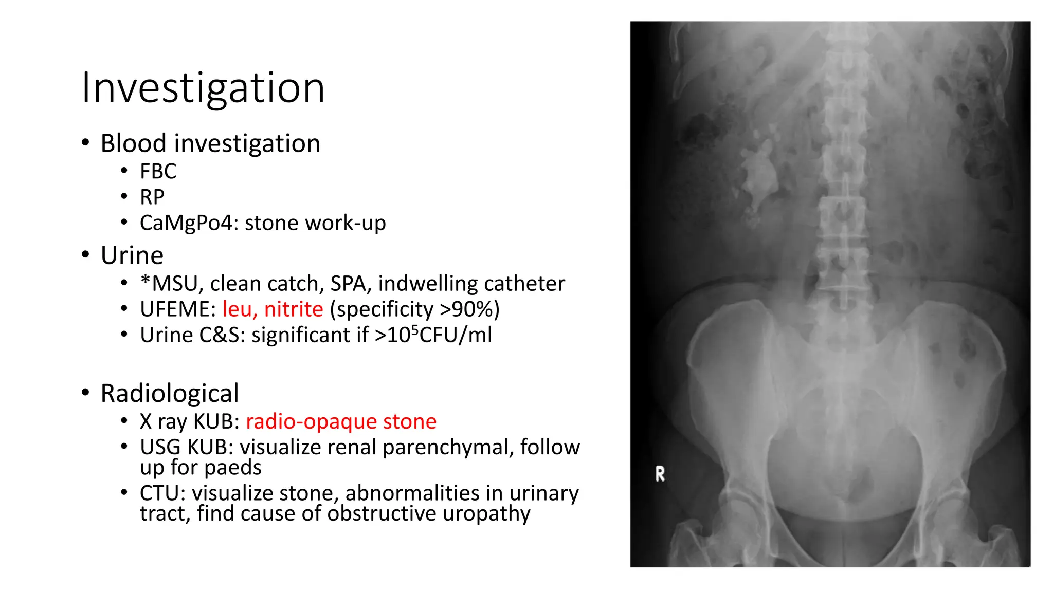 urinary tract infection UTI, infection, urinary | PPTX