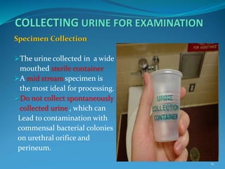 a lecture presentation about urinary tract infection | PPT