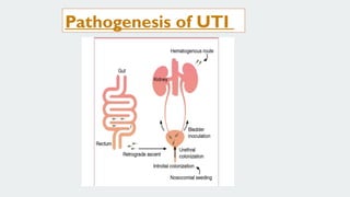 Urinary Tract Infection by Dr. Reazoan.pptx