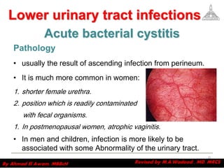 UTI | PDF | Infectious Diseases | Diseases and Conditions