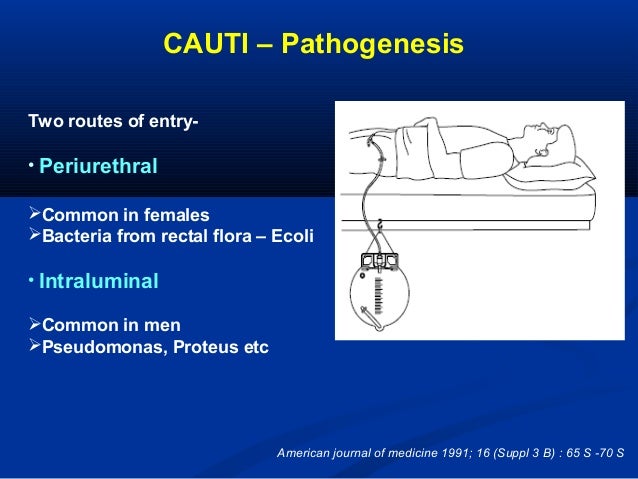 Uti -for_non-urologists-uncomplicated and complicated