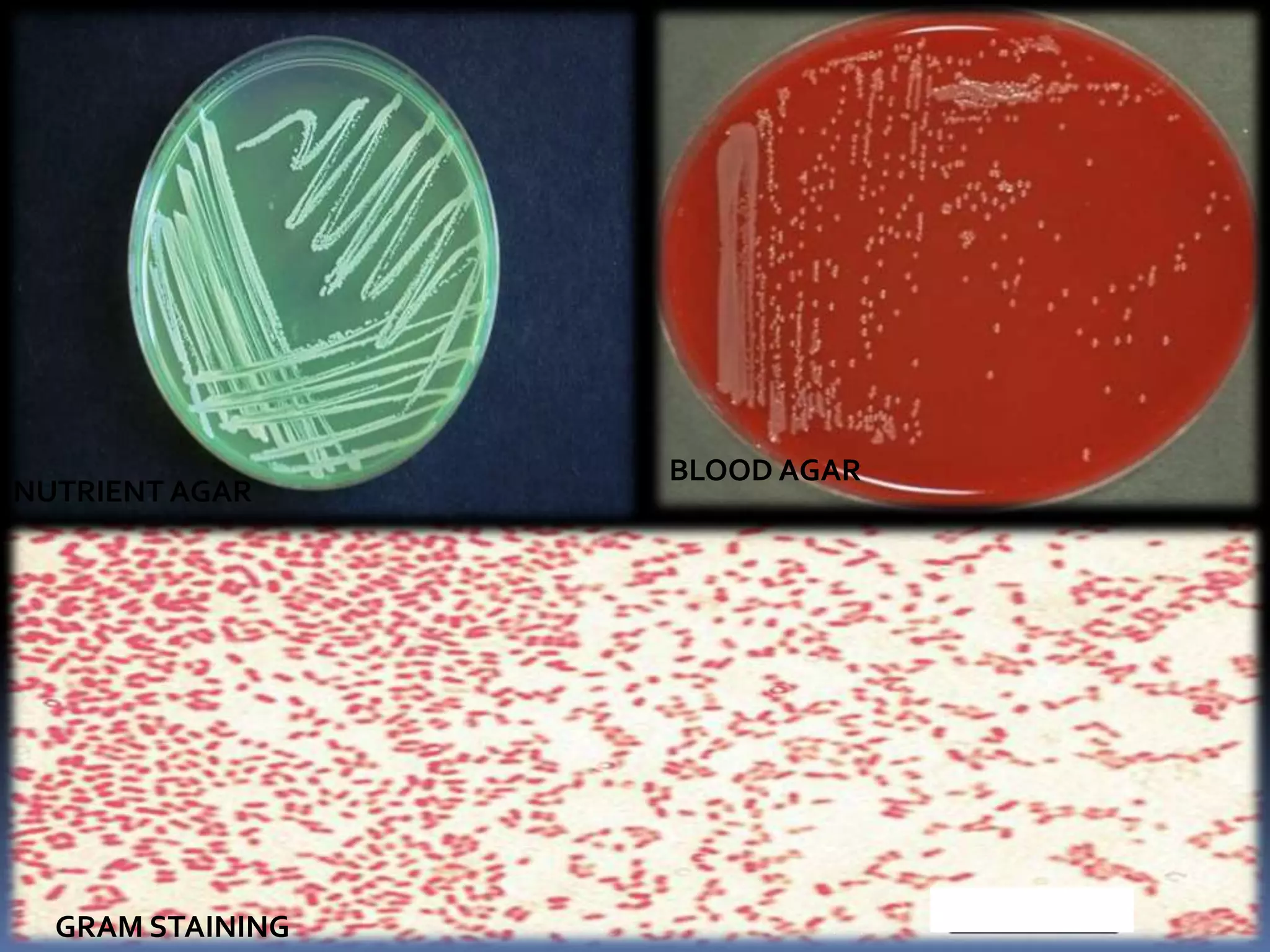 urinary tract infections-Lab diagnosis (e.coli, klebsilla, proteus ...