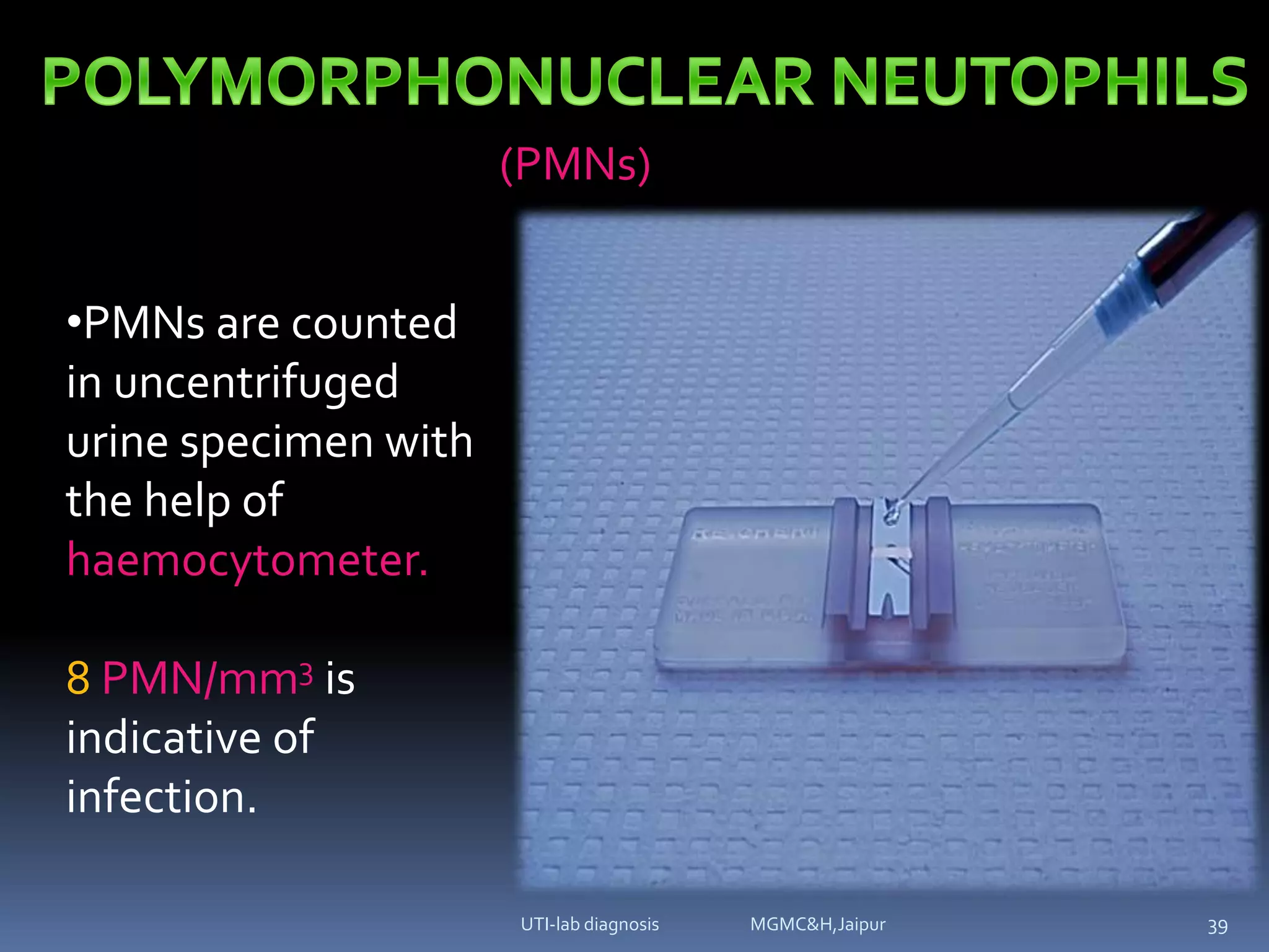 urinary tract infections-Lab diagnosis (e.coli, klebsilla, proteus ...