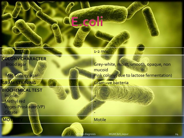 urinary tract infections-Lab diagnosis (e.coli, klebsilla, proteus ...