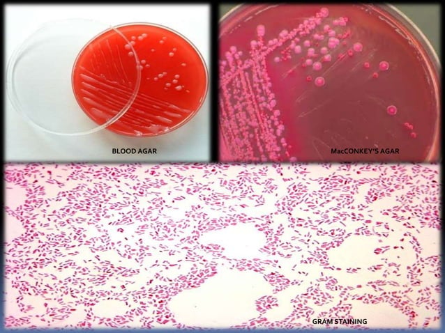 urinary tract infections-Lab diagnosis (e.coli, klebsilla, proteus ...