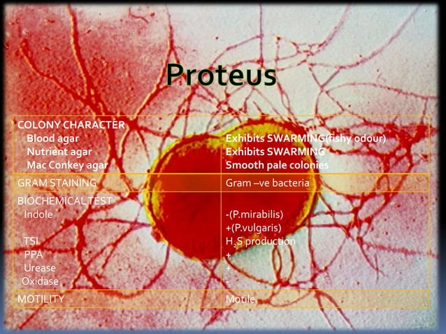 urinary tract infections-Lab diagnosis (e.coli, klebsilla, proteus ...