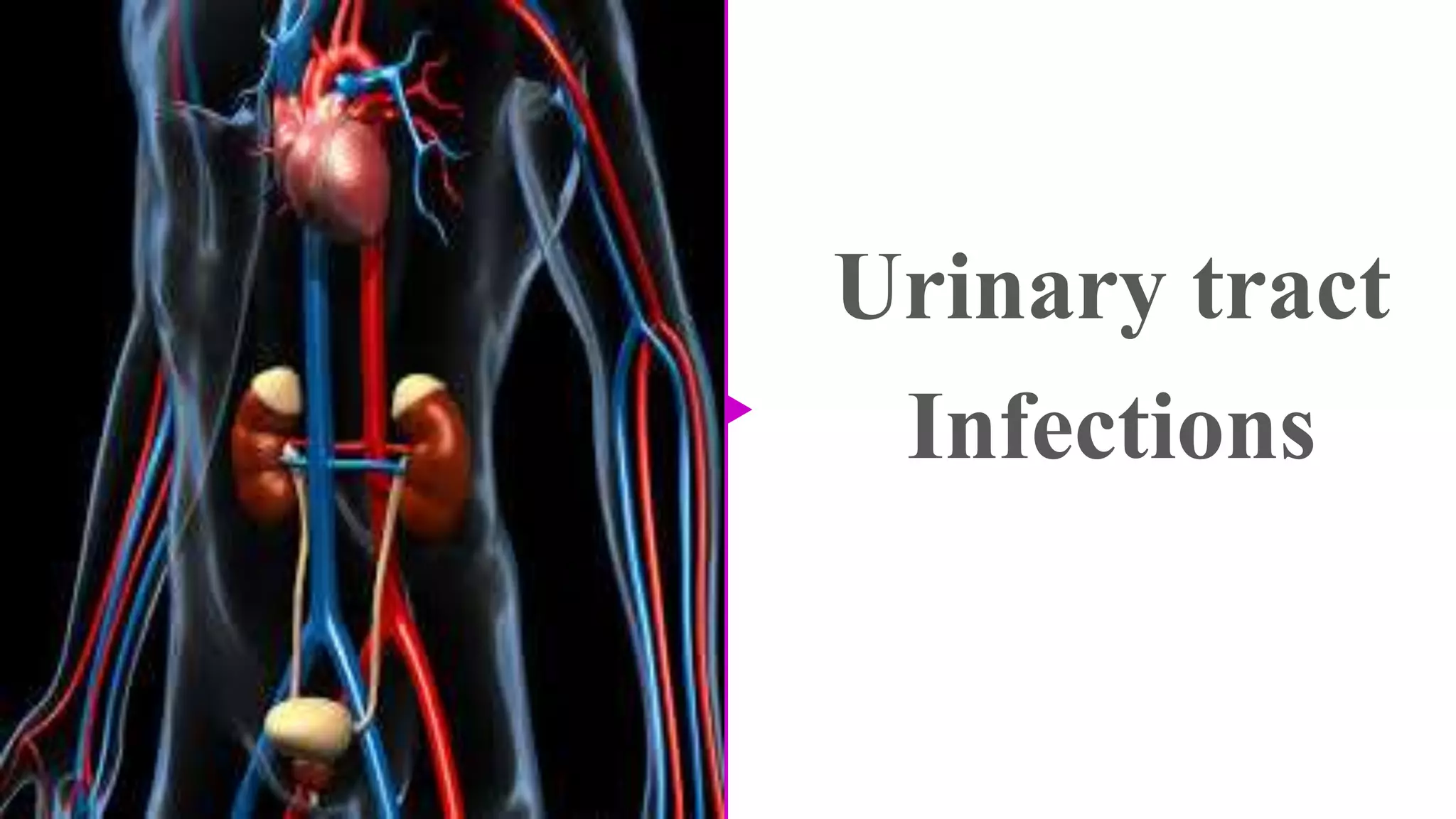 Clinical Cases Study for Urinary tract infections | PPTX