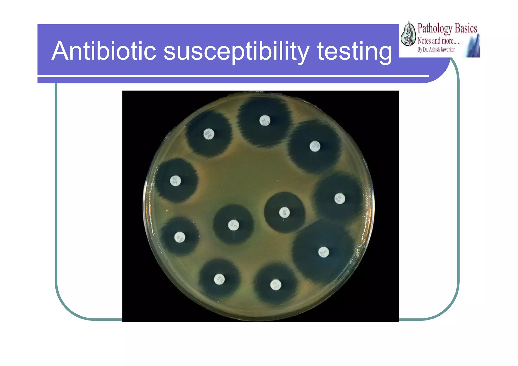 URINARY TRACT INFECTION - MICROBIOLOGY | PDF