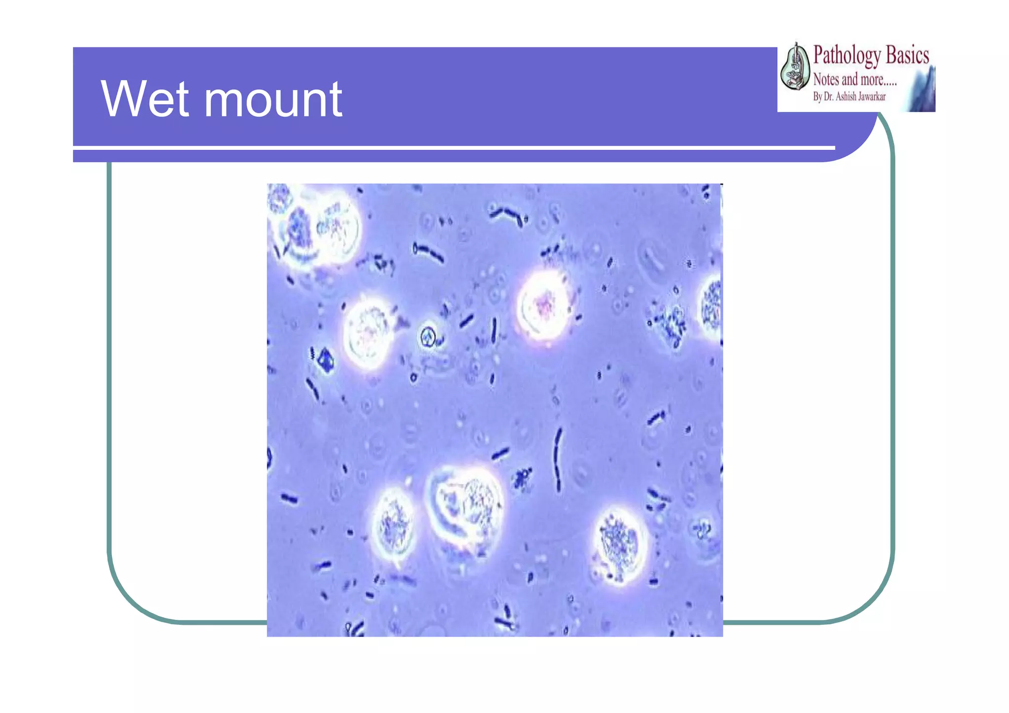 URINARY TRACT INFECTION - MICROBIOLOGY | PDF