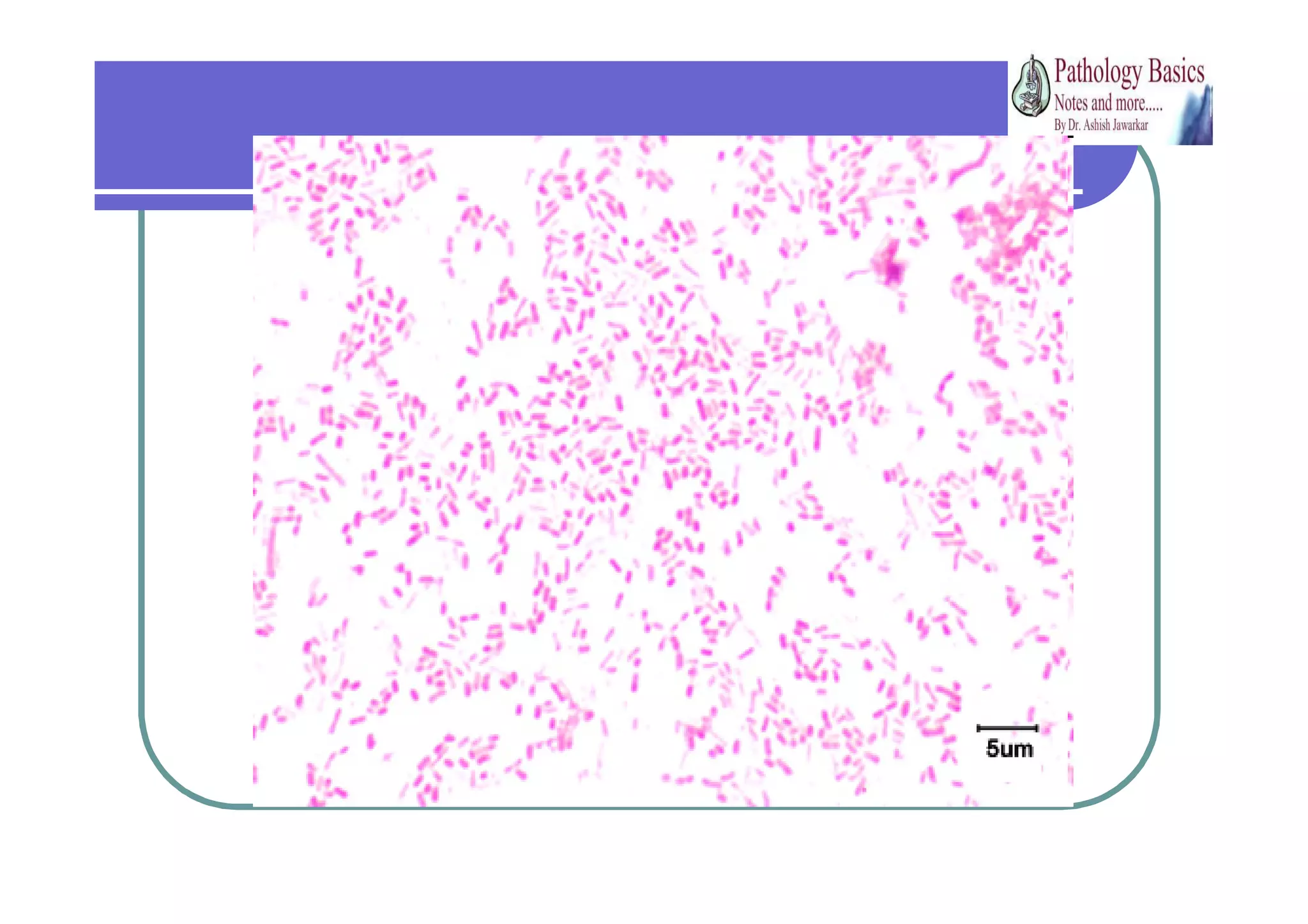 URINARY TRACT INFECTION - MICROBIOLOGY | PDF