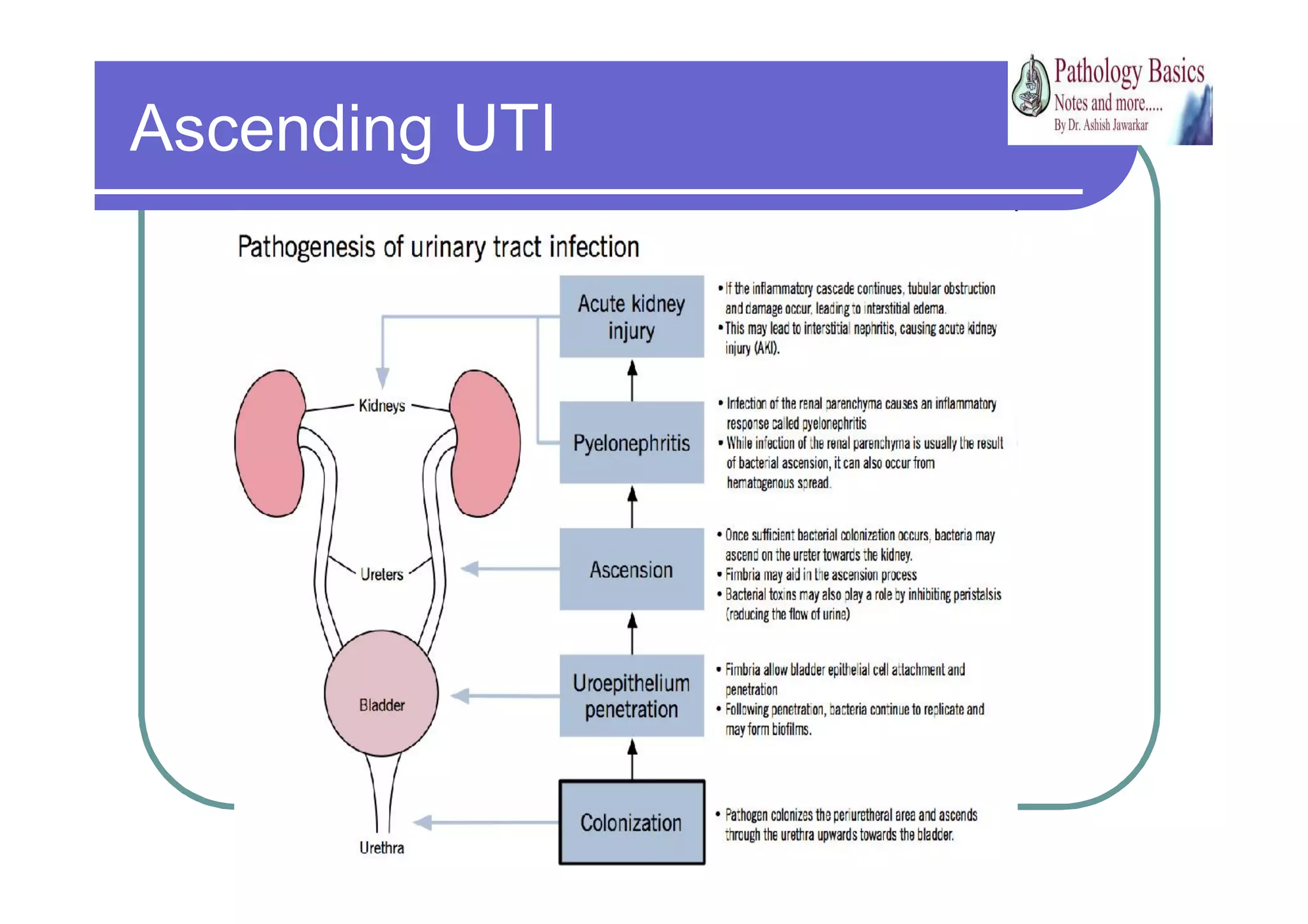 URINARY TRACT INFECTION - MICROBIOLOGY | PDF