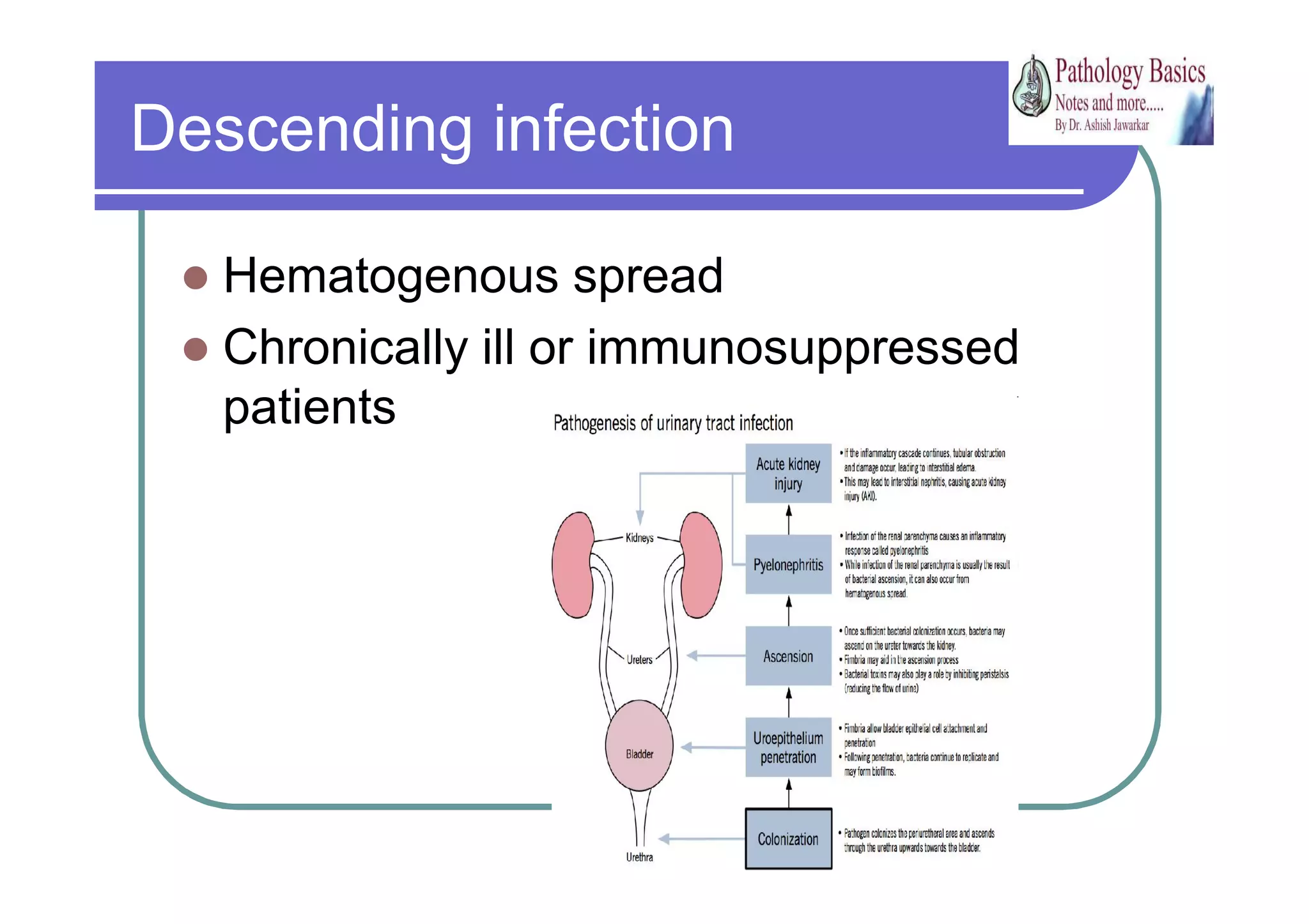 URINARY TRACT INFECTION - MICROBIOLOGY | PDF