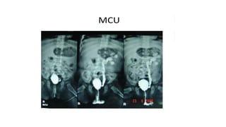 Uti copy.pptx approach to uti, steps uti | PPTX