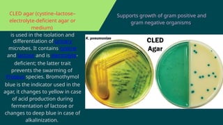 Laboratory diagnosis of UTI (Practical). | PPTX