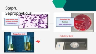 Laboratory diagnosis of UTI (Practical). | PPTX