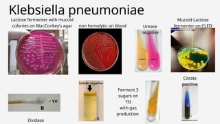 Laboratory diagnosis of UTI (Practical). | PPTX