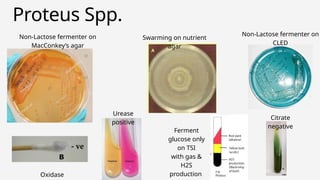 Laboratory diagnosis of UTI (Practical). | PPTX