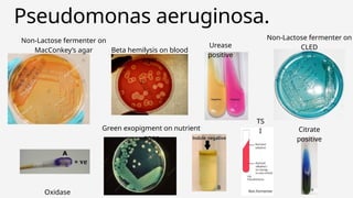 Laboratory diagnosis of UTI (Practical). | PPTX